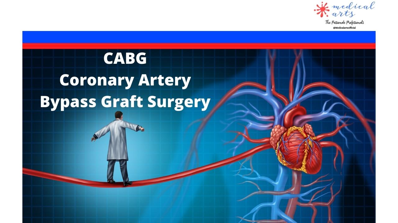 CABG - Coronary Artery Bypass Surgery – Medical Arts Shop