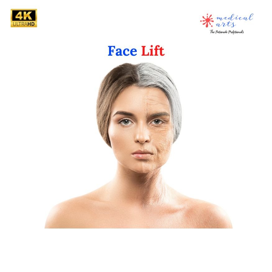 Face lift & Mini Face Lift Surgery - Video Included – Medical Arts Shop